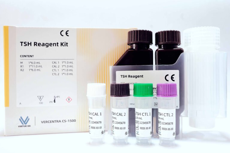 Reagen Immunology – TSH - Virtue Diagnostics Indonesia
